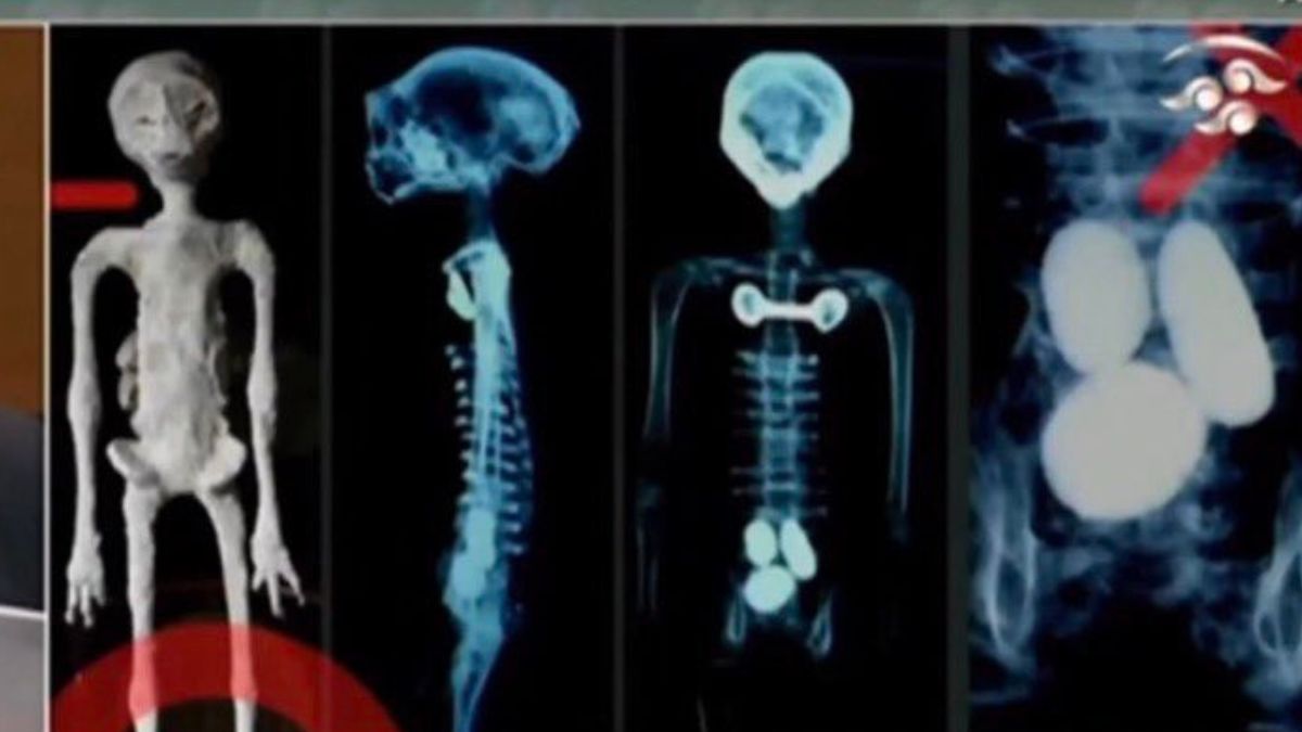VIDEO: Mexico Congress Unveils Two 'Alien Corpses' Believed To Be 1,000 Years Old